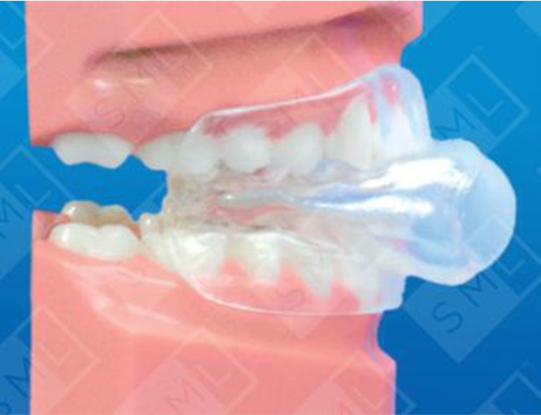 The orthodontist and obstructive Sleep Apnea - an orthodontic perspective