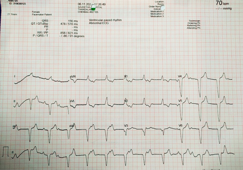 Cardiac Conduction Defects and Pacemaker in Pregnancy – Case Series